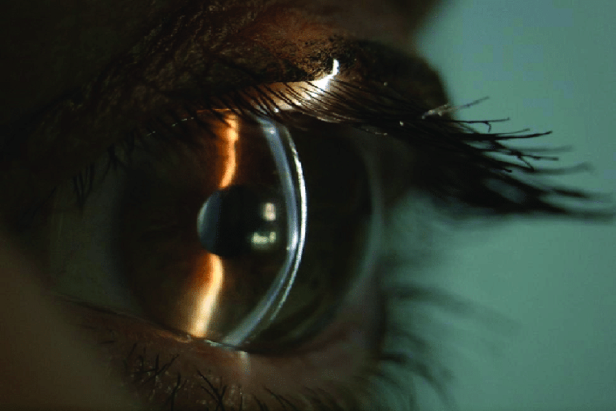 Short Slit Technique In Eyes